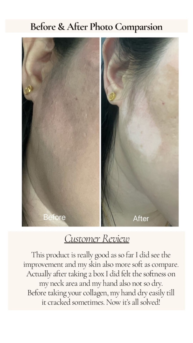 NSJ WELLNESS Intense Collagen Glow (INSTOCKS) | Shopee Singapore