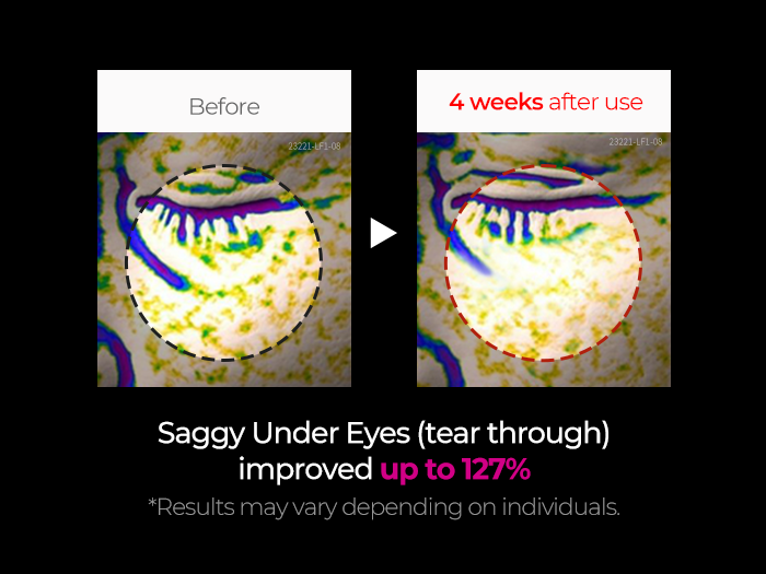 [DR.MELAXIN Official] Cemenrete Calcium ampoule, cream DUO set ...