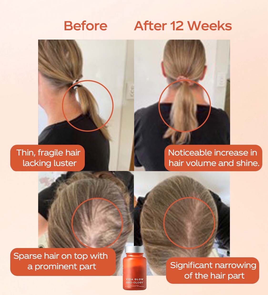 【9.9 Sales】 Vida Glow Gro-Ology / Hairology Advanced Repair 【hair ...