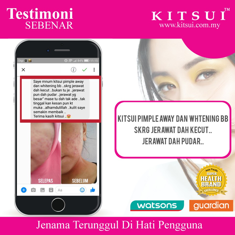 Kitsui Pimple Away - Acne | Shopee Singapore