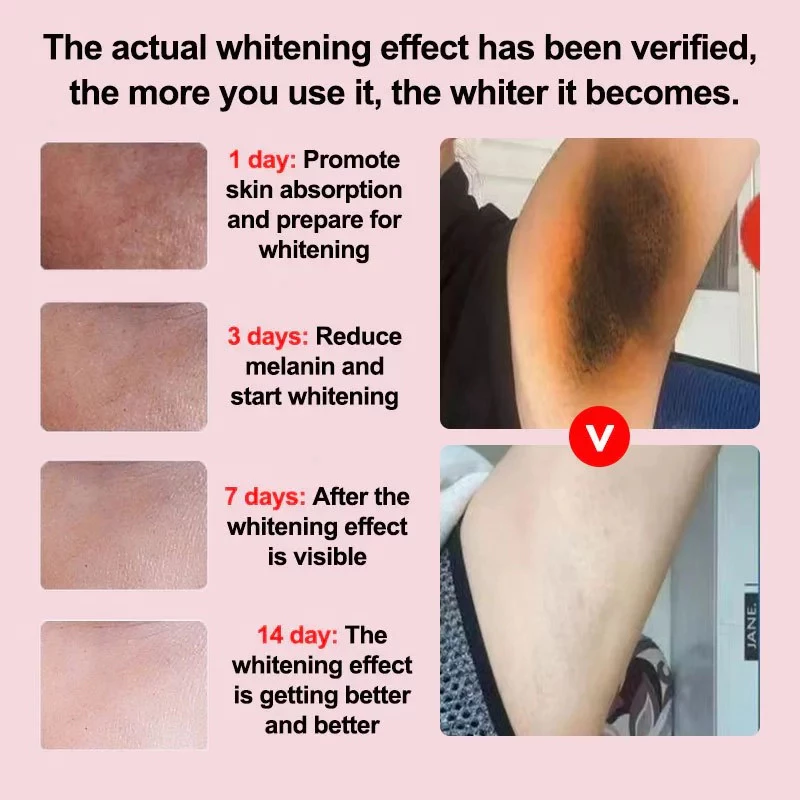 【🇸🇬Ready 】Inguinal Whitening cream whitening body remove melanin ...