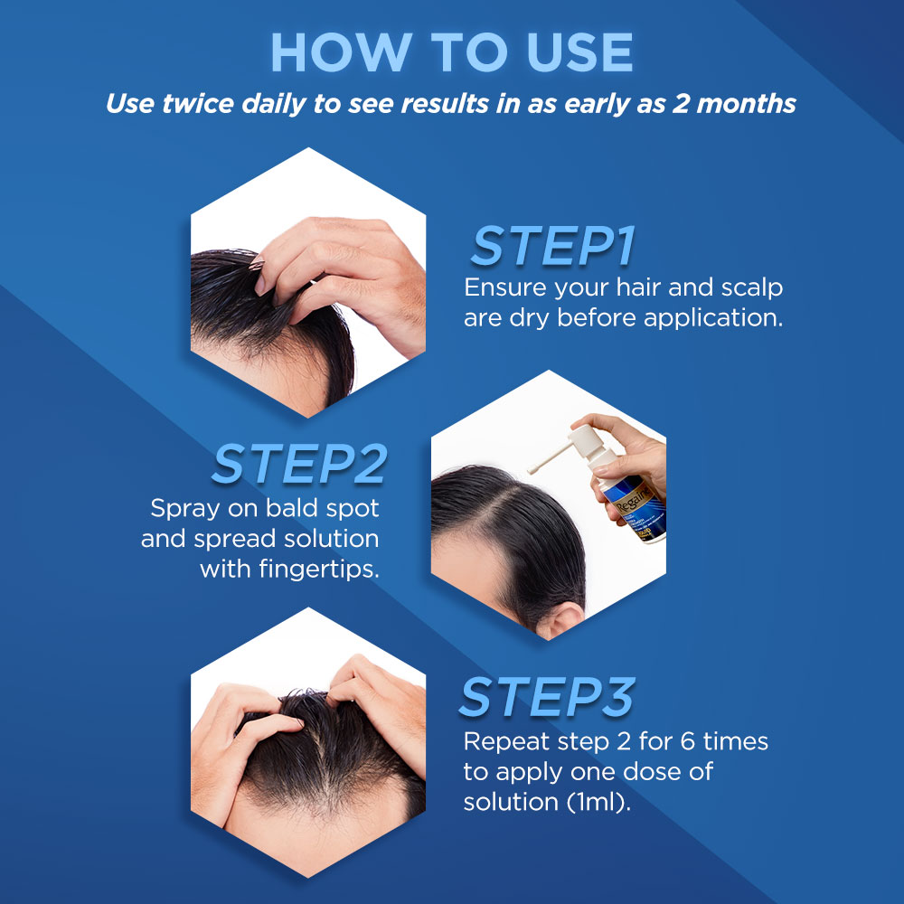 [Bundle of 3+1] Regaine Extra Strength 5% Minoxidil Stop Hair Loss ...