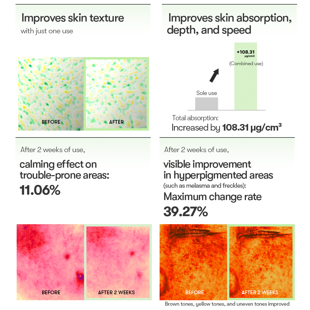 [VT] REEDLE SHOT 100 / 300 / 700 Silica, Microneedling skin booster ...