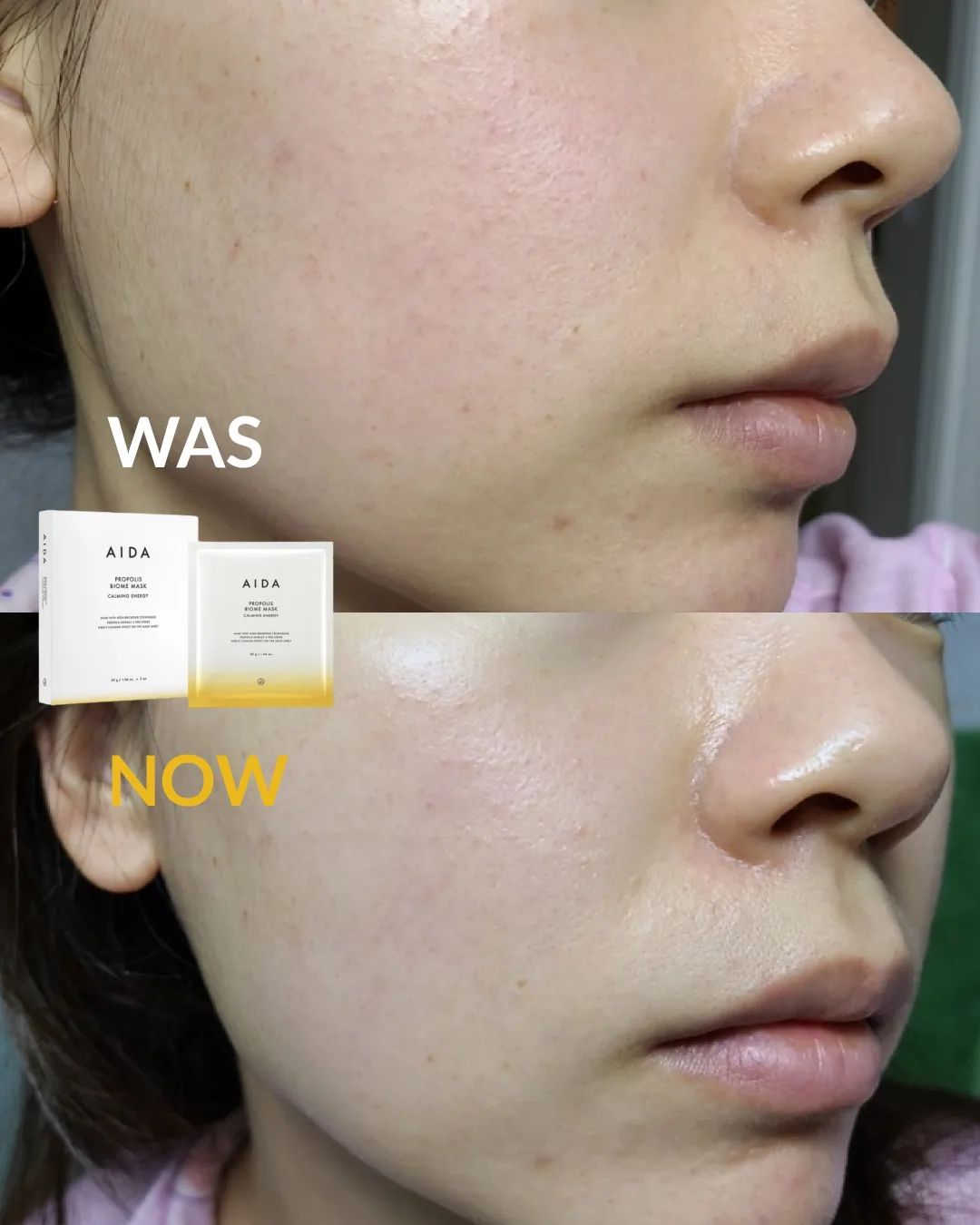 (AIDA OFFICIAL STORE) Propolis Biome Mask | Glutathione Brightening ...