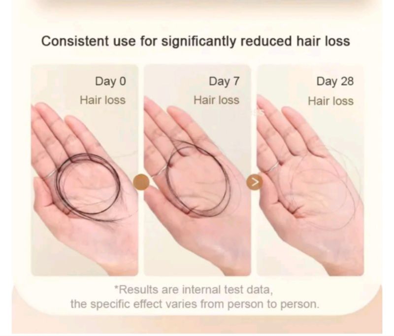 SG KARALOVE 200ML GINGER PLANT EXTRACT 10 SACHETS * 20ML Anti-Hair Loss ...