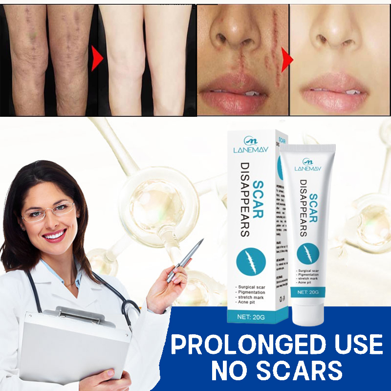 Mosquito Bite Scar Removal Cream Keloid Scar Removal Stretch Mark ...