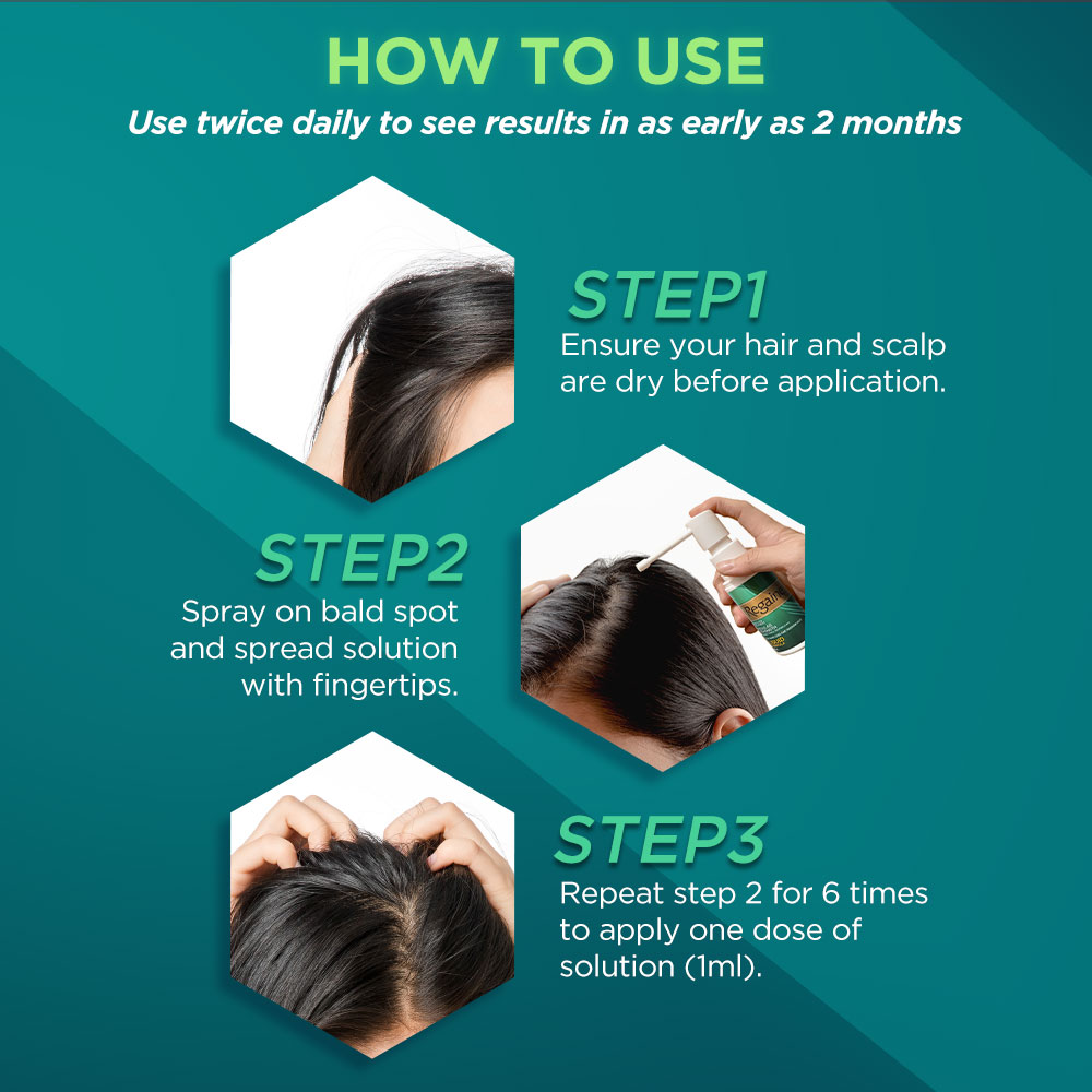 Regaine Regular Strength Minoxidil Topical Solution 2% Minoxidil ...