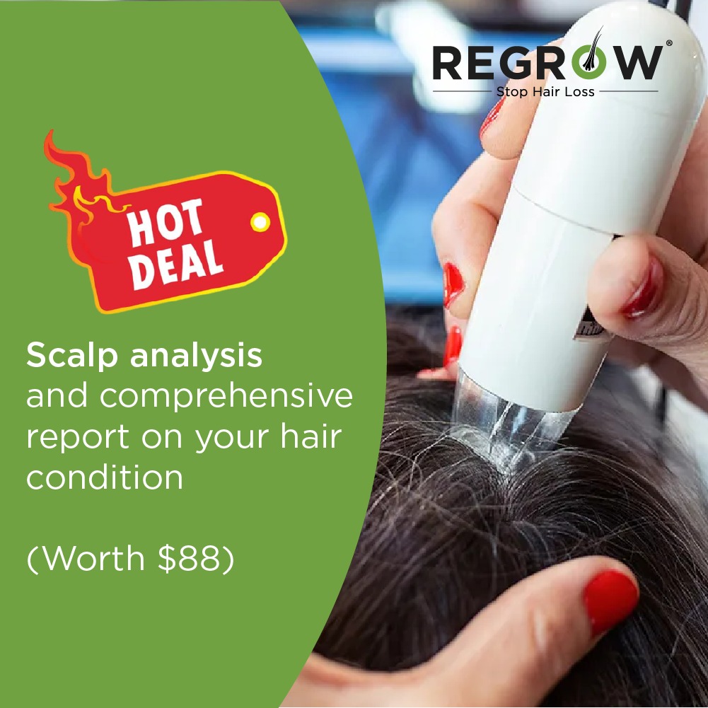 Regrow Hair Growth Tonic | Hair Loss Treatment Spray (120ml) | Shopee ...