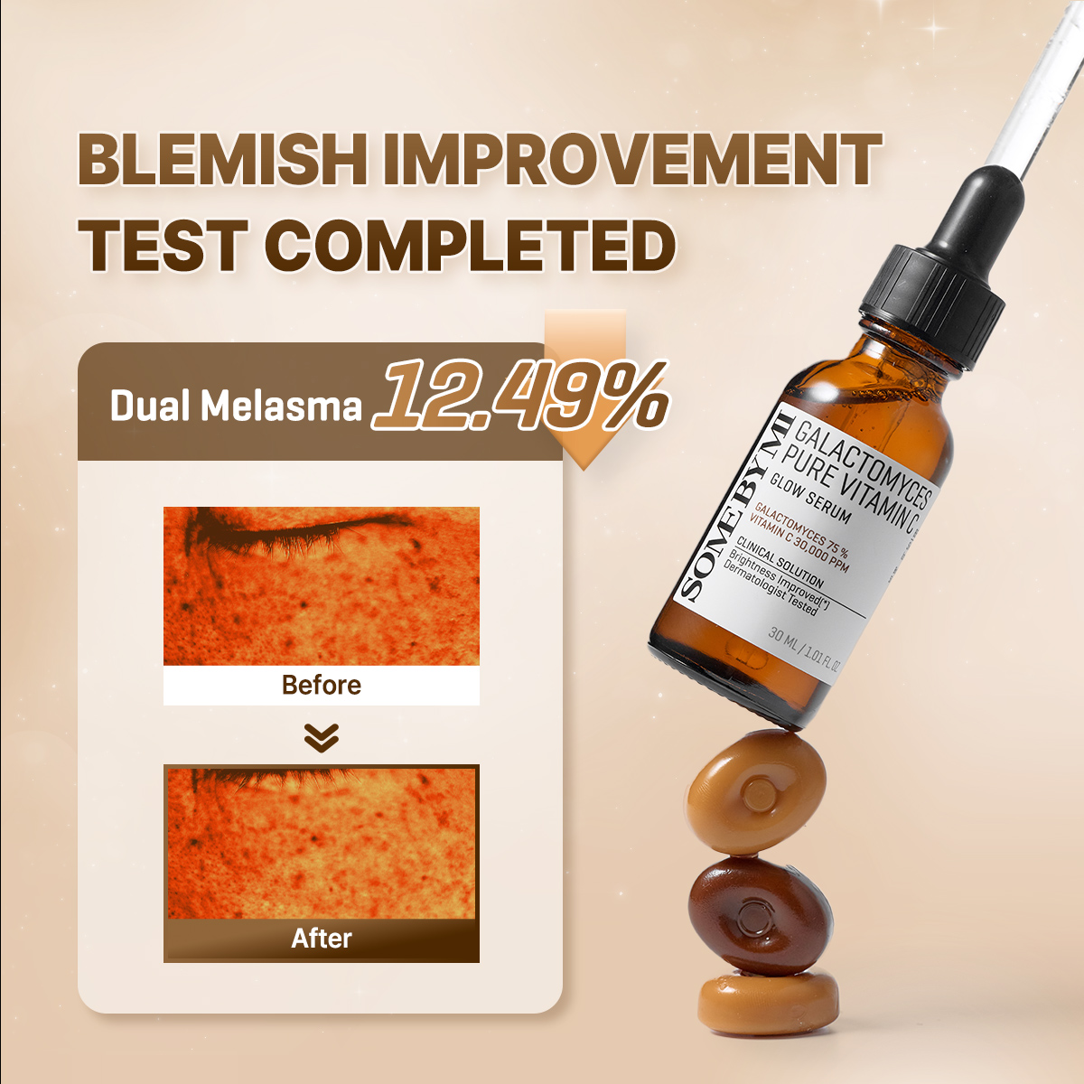 [SOME BY MI] Galactomyces Brightening Trial kit (10ml+10ml ...