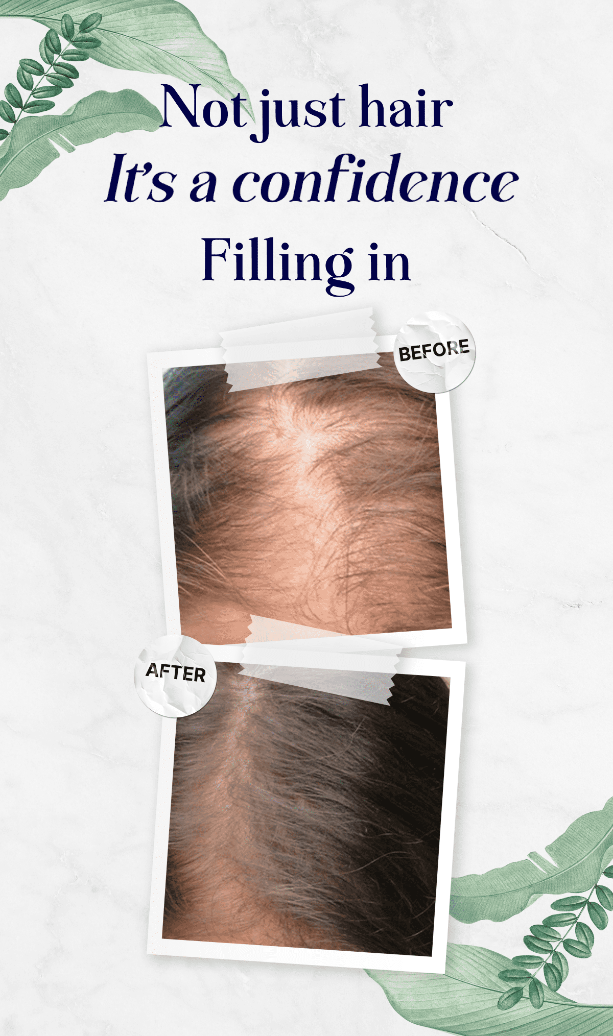PRIMUCELL for Hair Therapy, Anti-Hair Loss Ampoule (32weeks care ...