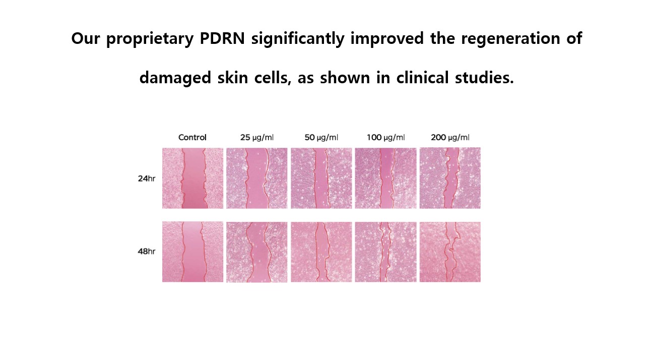 [Rejuveon] PDRN 1000+ Plus Cream 20g – Same Formula as Rejuvenex ...