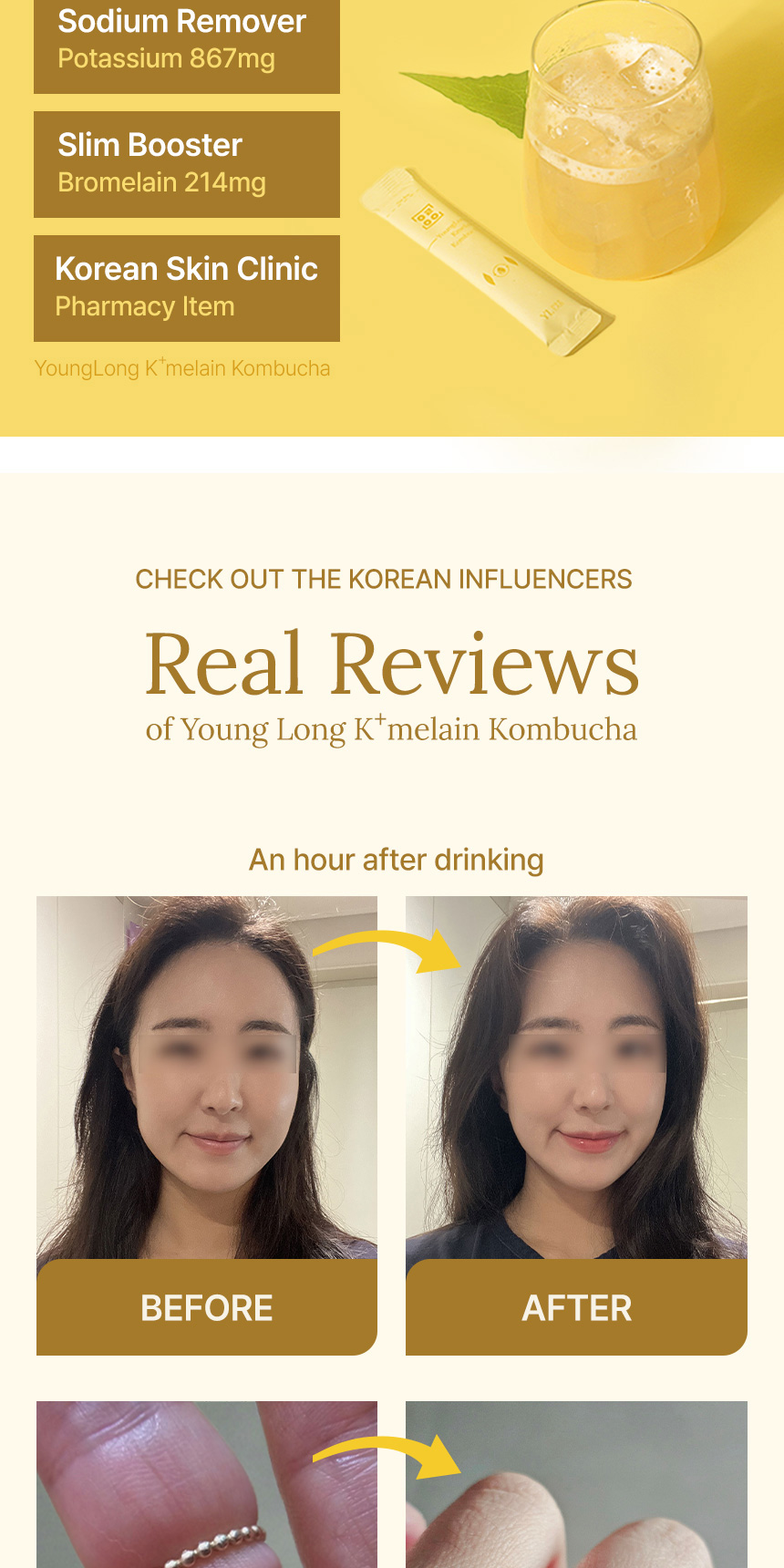 [YOUNGLONG] Slimming Kombucha with Bromelain / Digestive Enzyme & Diet Tea / Bloating Relief ...