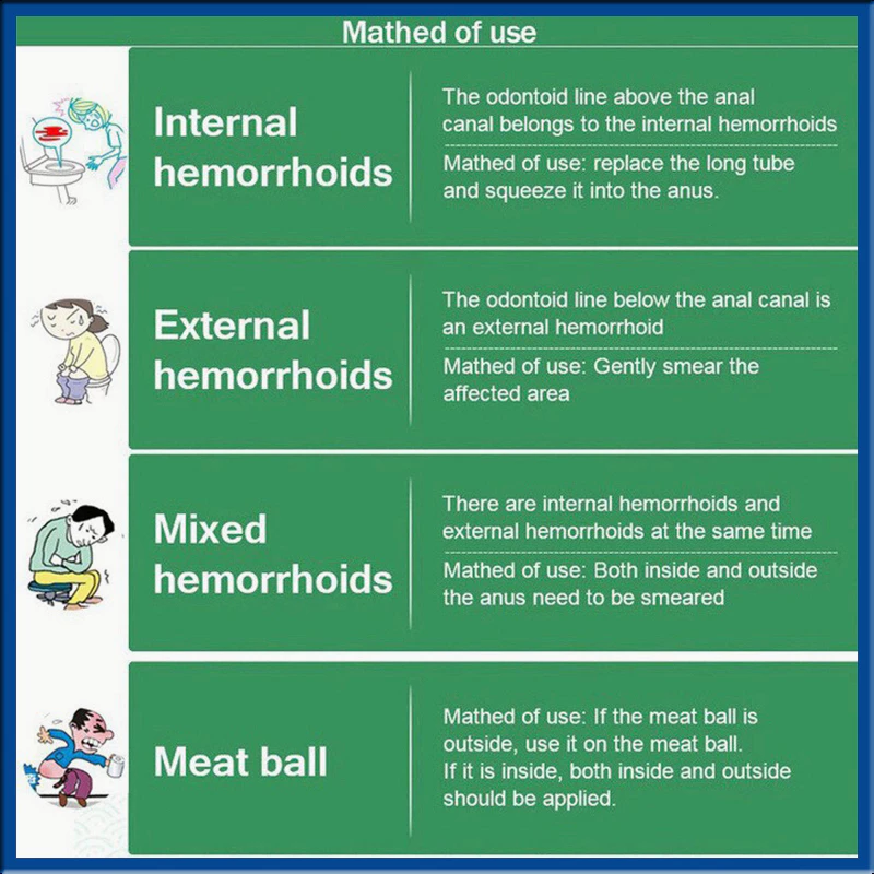 Piles Hemorrhoid Cream || Topical Ointment for Swollen and Inflamed ...
