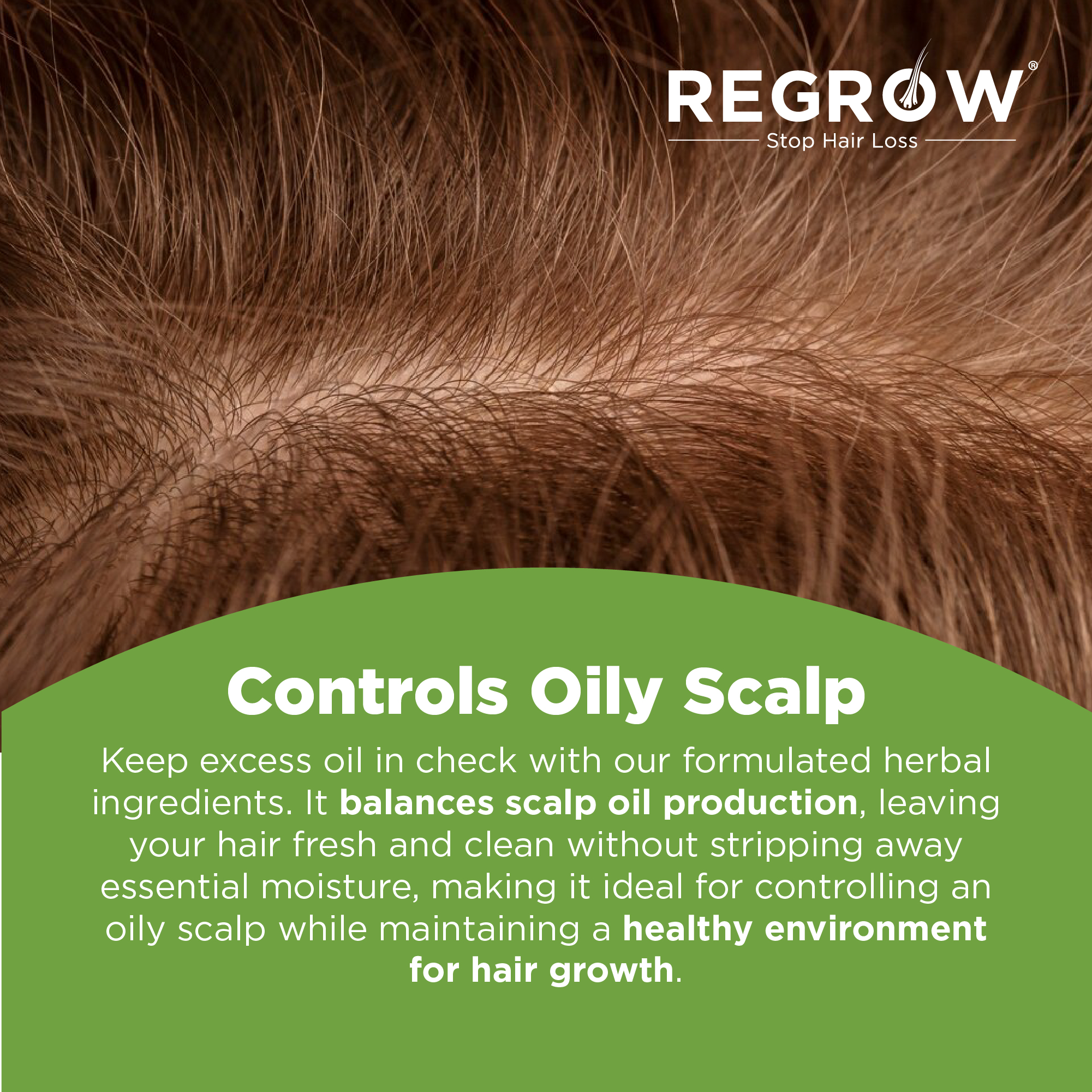 REGROW Anti Hair Loss Shampoo Herbal | Hair Growth Shampoo (300ml ...