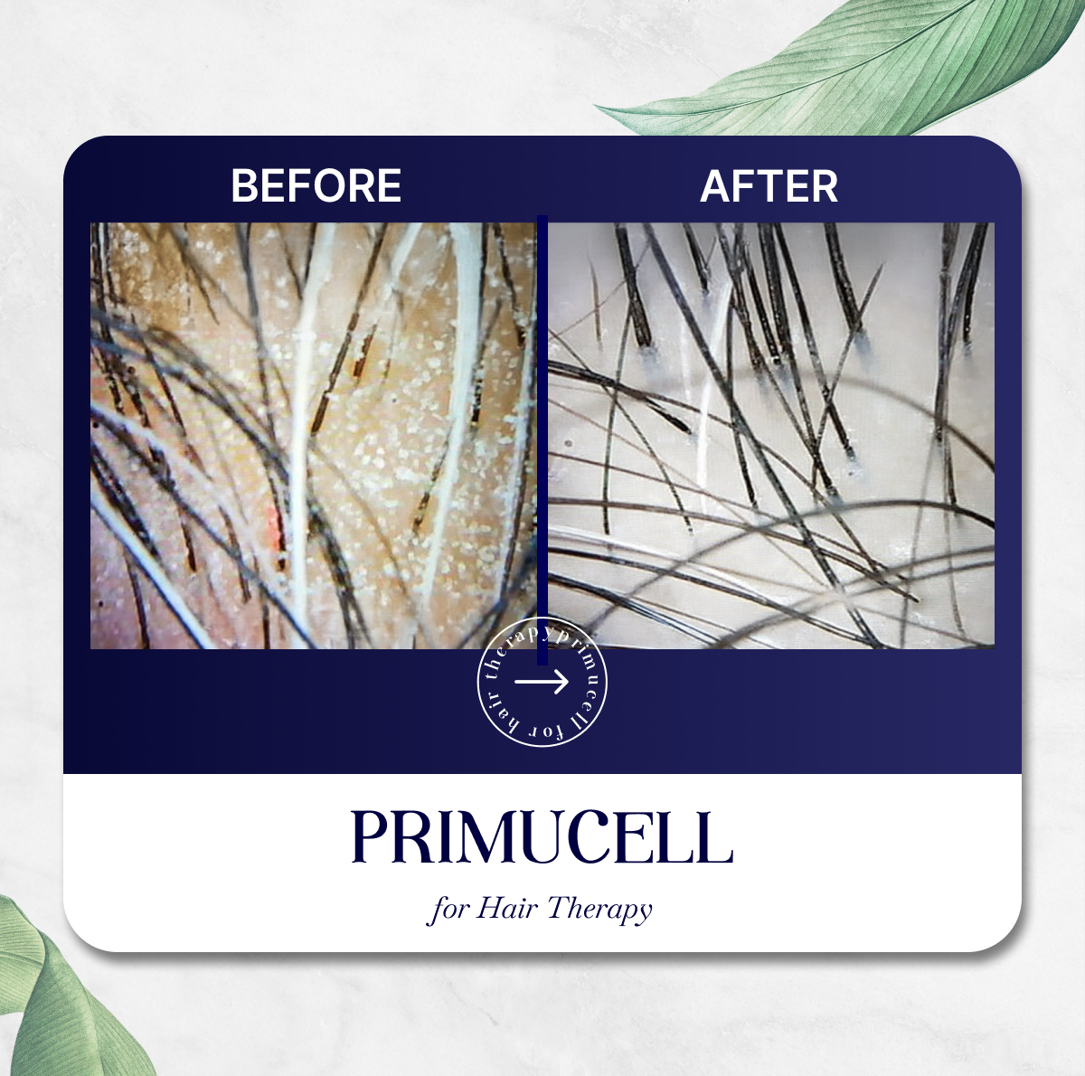 PRIMUCELL for Hair Therapy, Anti-Hair Loss Ampoule (32weeks care ...