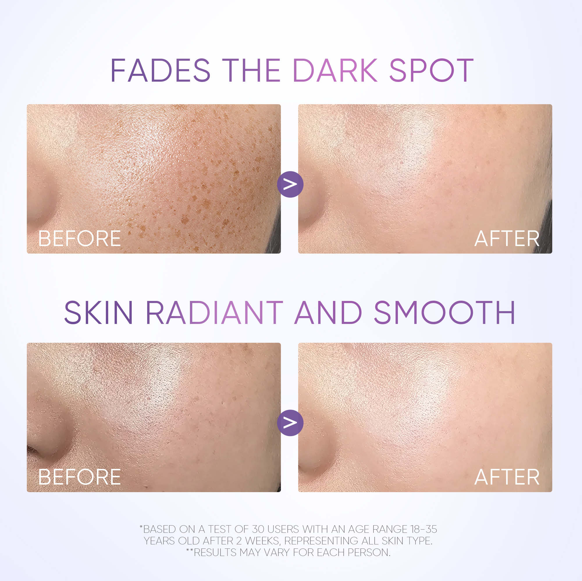 SKINTIFIC Serum Series 377 Dark Spot /Retinol/Brightening/Whitening ...