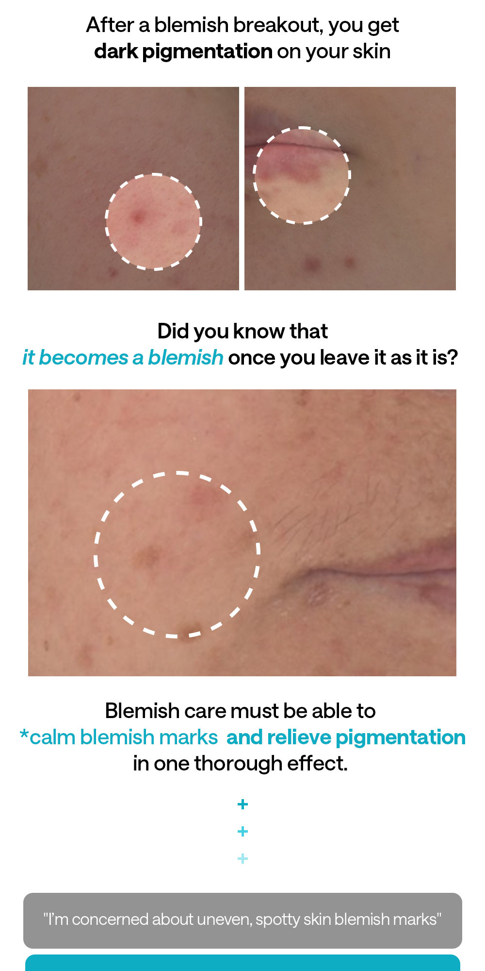 MEDIHEAL *NEW* Madecassoside Blemish Repair Serum 40ml : Relieve Skin ...