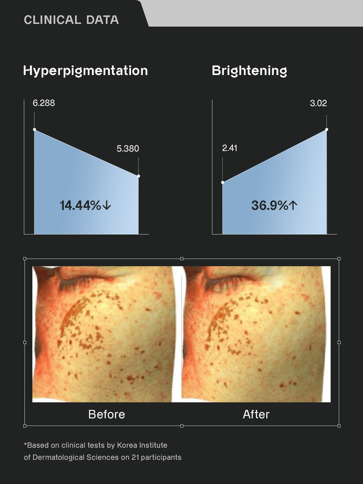 [ TB1 ] OGANACELL Bio Actiome Whitening Series Essence Toner 120ml/Gel ...