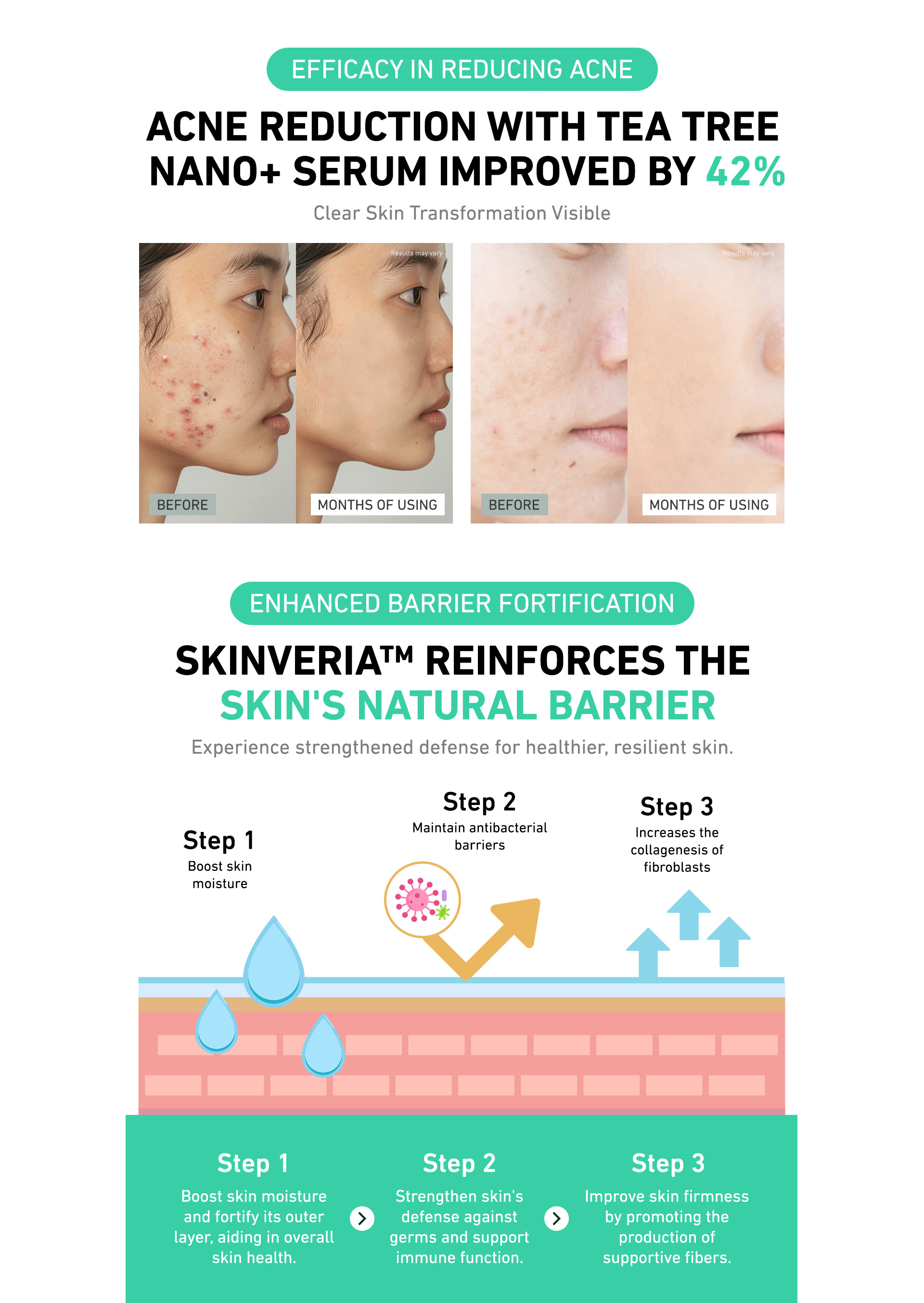 [Buy 1 Get 1] Nano Skinz SG Tea Tree Oil Serum 30ml Anti-acne, Controls ...