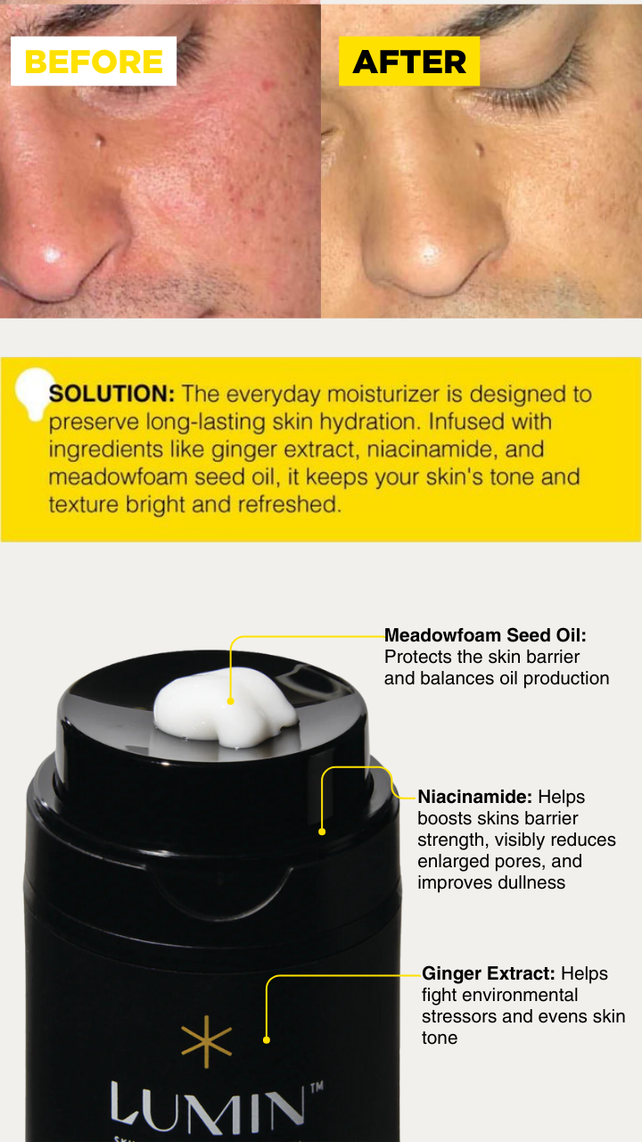 LUMIN | Men’s Face Moisturizer (Daily, Extra, Light) - Combat Hydration ...