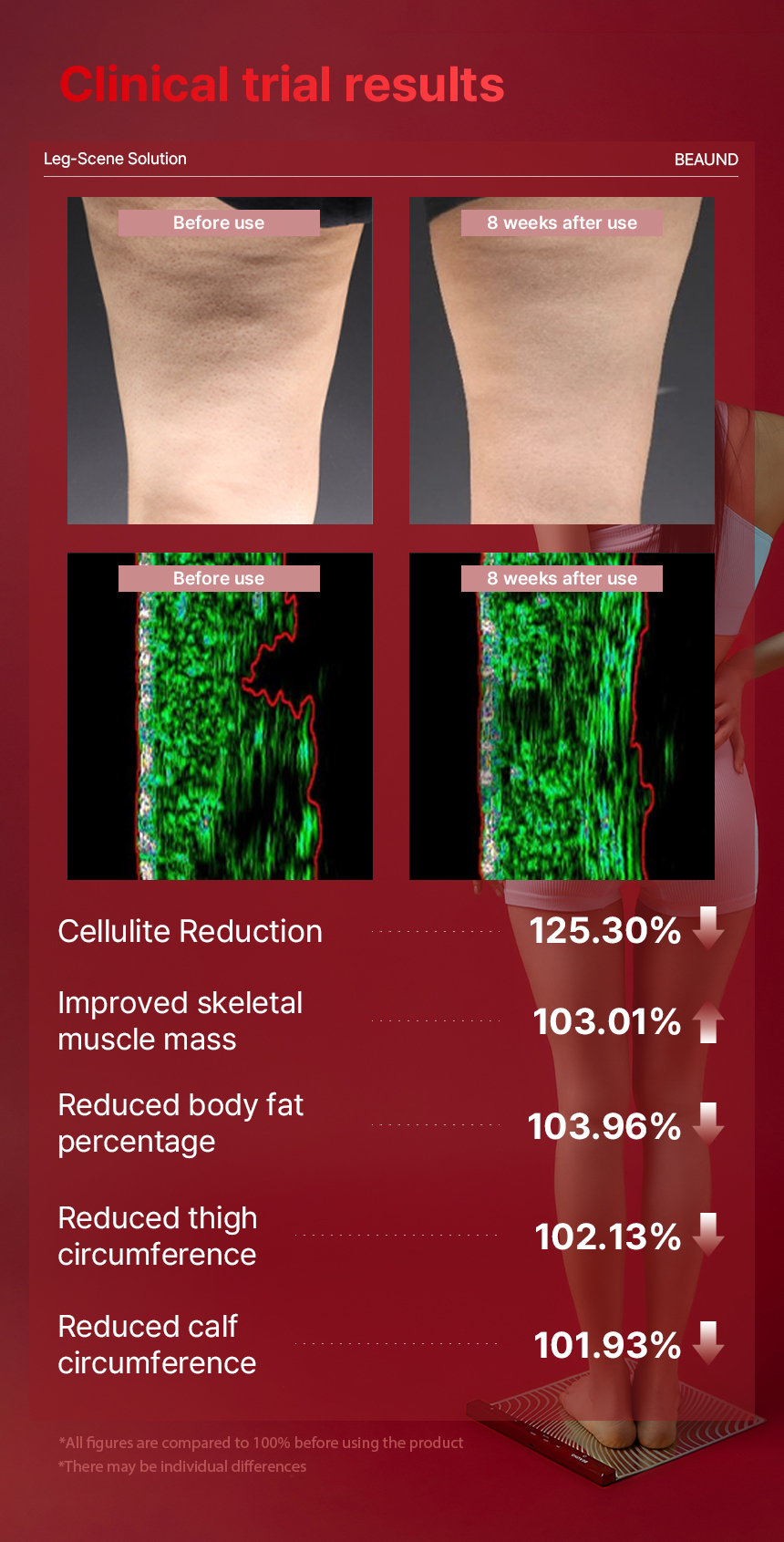 [Beaund] LEG SCENE Cellulite Removal Massager with EMS Muscle ...