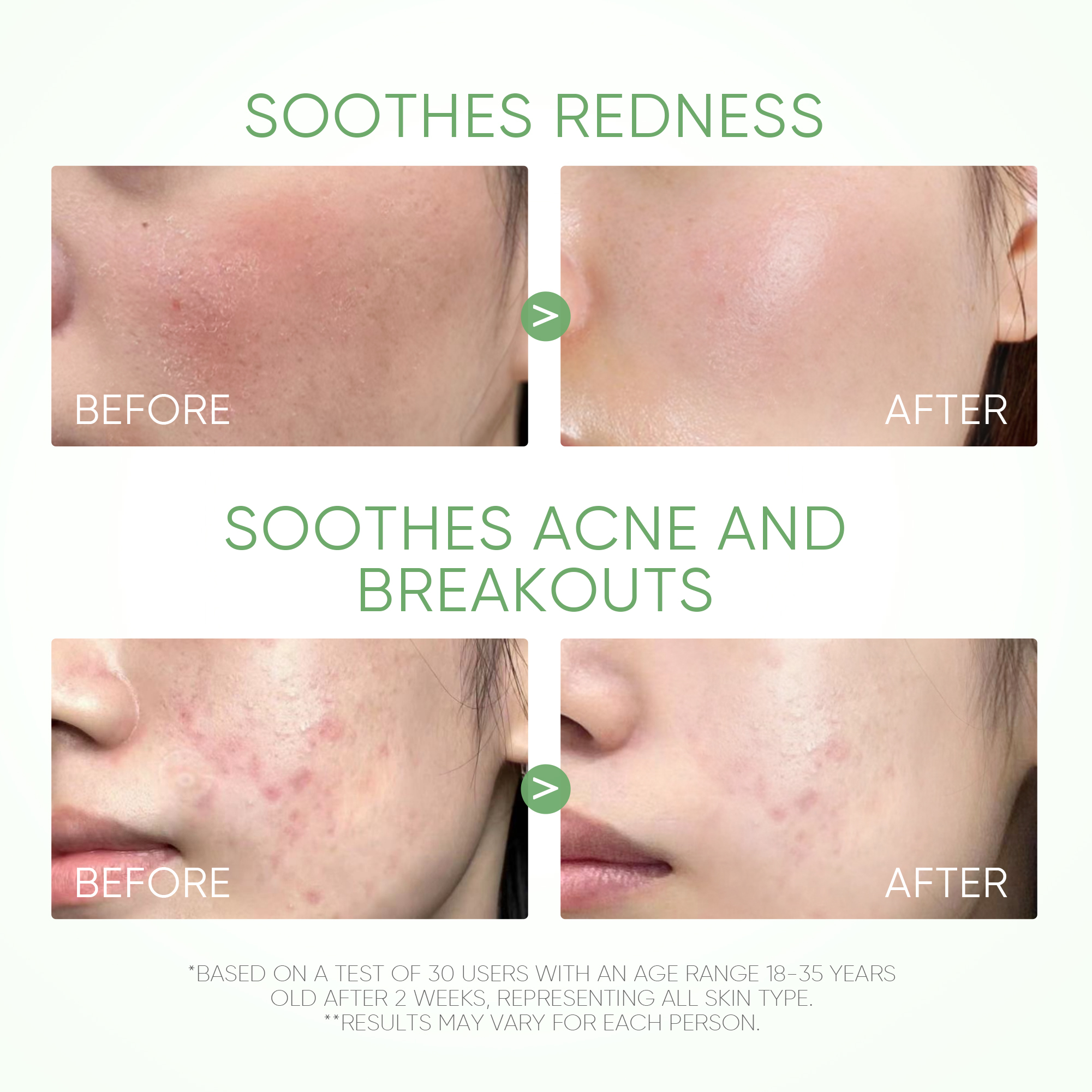 SKINTIFIC Mugwort/Niacinamide/Volcano Acne Clay Stick Mask - Cleanses ...