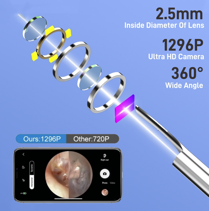 21 in 1 Smart Visual Earpick with 1296P Camera, Otoscope Earwax Remover ...