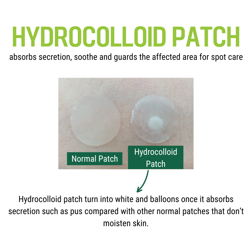 Curesys Teatree Acpair Deep Spot Patch Hydrocolloid Acne Pimple Blemish ...