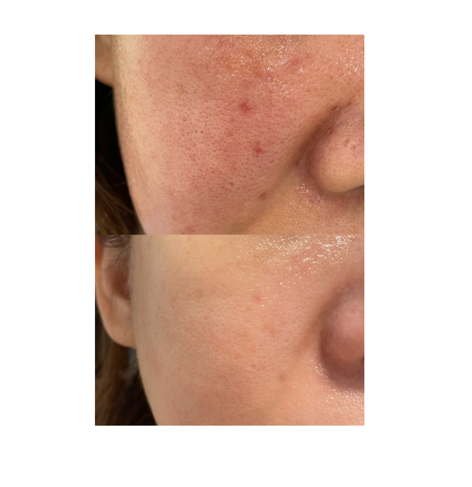 [VIBANQUENTMANKA] VQM Phytocin Restorative Cream 30ml / 1ml Sachet ...