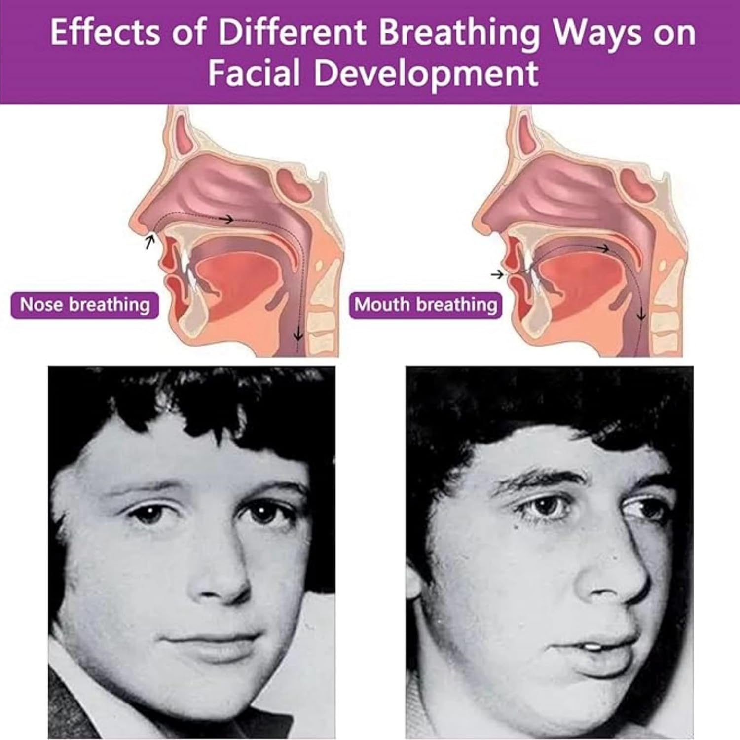 SG SELLER Japan Anti Snoring Patch Good Sleep Insomnia Breatheable ...