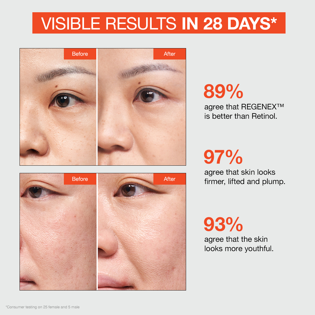 MODERN MOLECULES Regenex Renewal Serum (For Anti-Aging, Anti ...