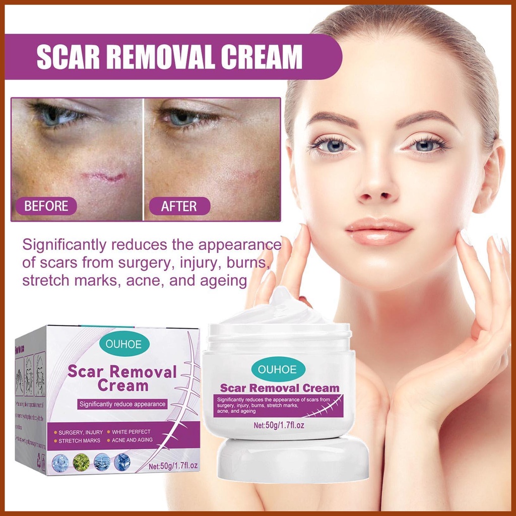 Scar Removal Cream Old Scars Mosquito Bite Scar Keloid Scar Burns Scald ...