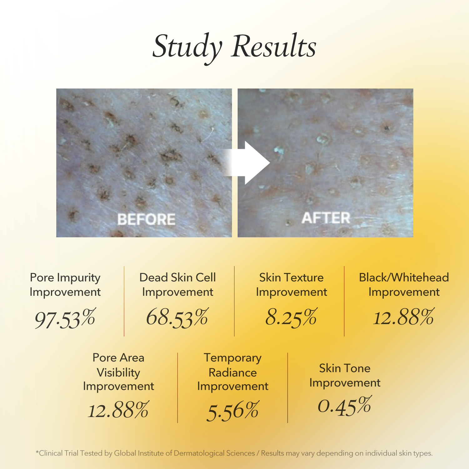 [APRILSKIN official] Calendula Peel Off Facial Mask - Gently exfoliates ...