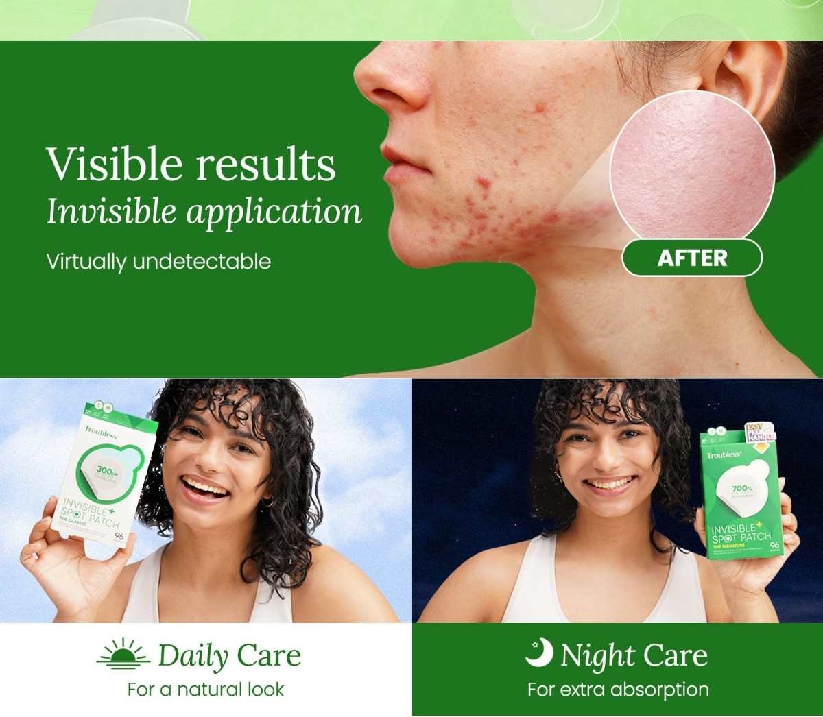 [Troubless] Invisible Plus Spot Patch The Classic 96pcs *5pcs (pimple ...