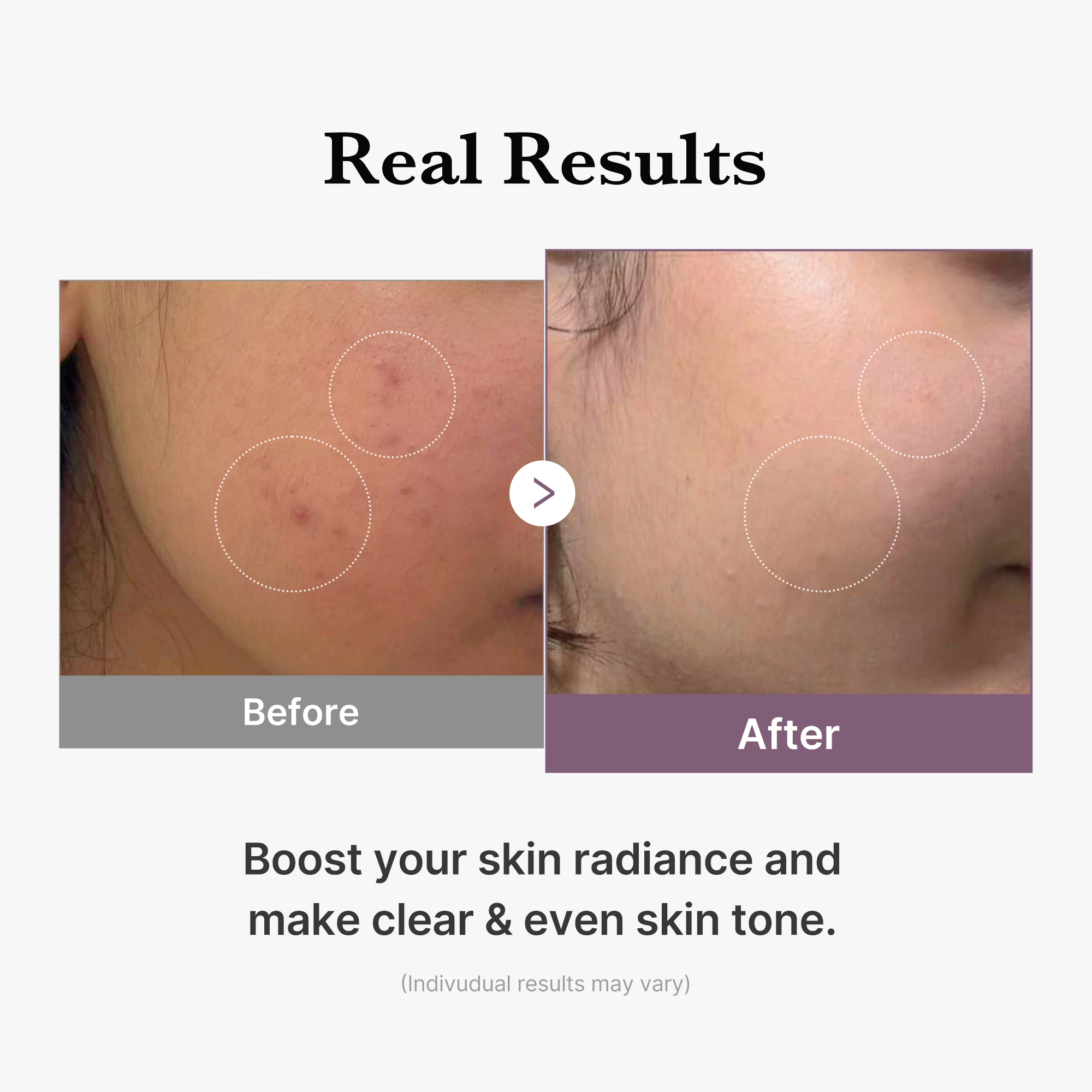 [medicube official] Age-R Glutathione Glow Milky Toner 140ml - Double ...