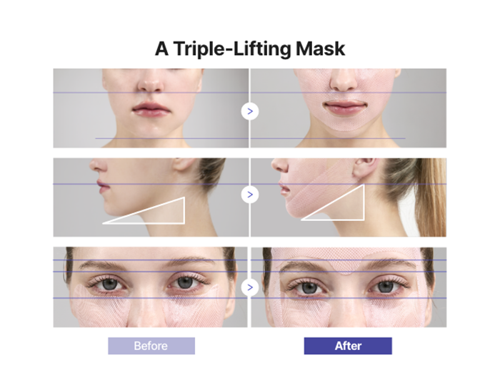 [MEDITHERAPY] Tension Up Lifting Mask 5ea, 1box/ Ati-aging & Sagging ...