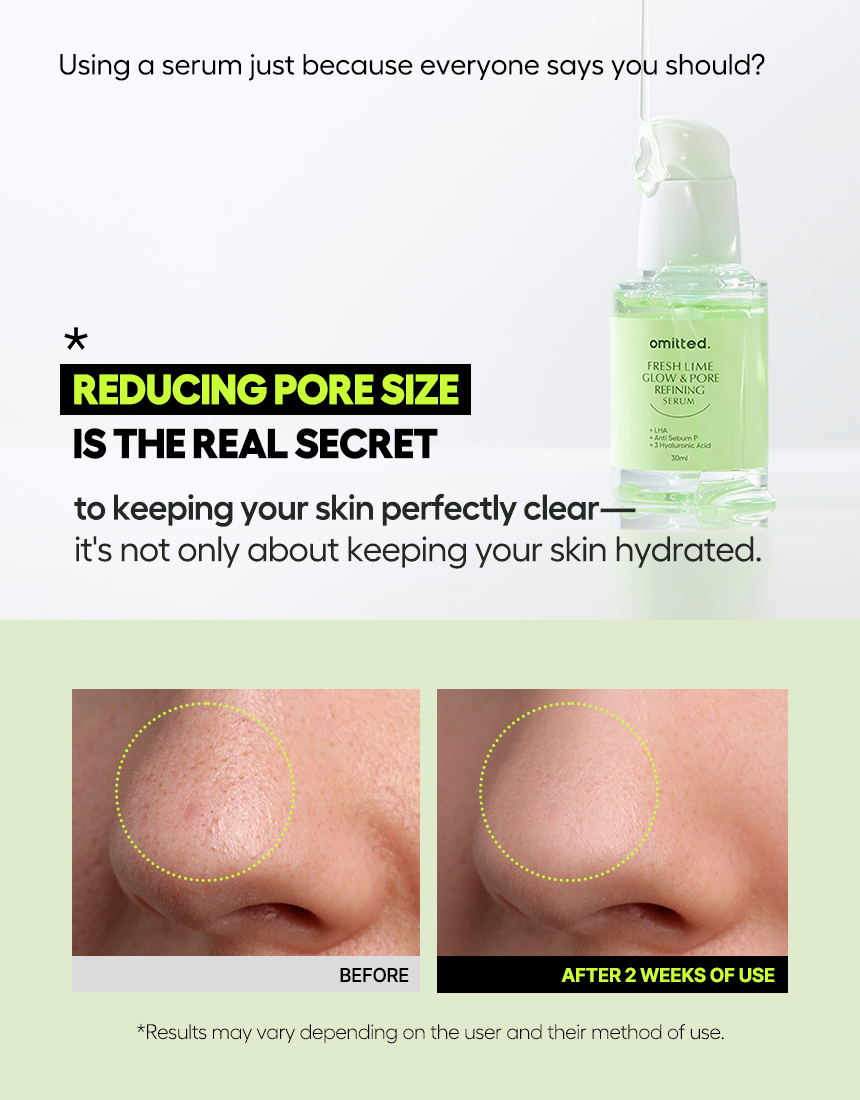 [Clinically Tested] Pore Tightening Serum 30ml | Shopee Singapore