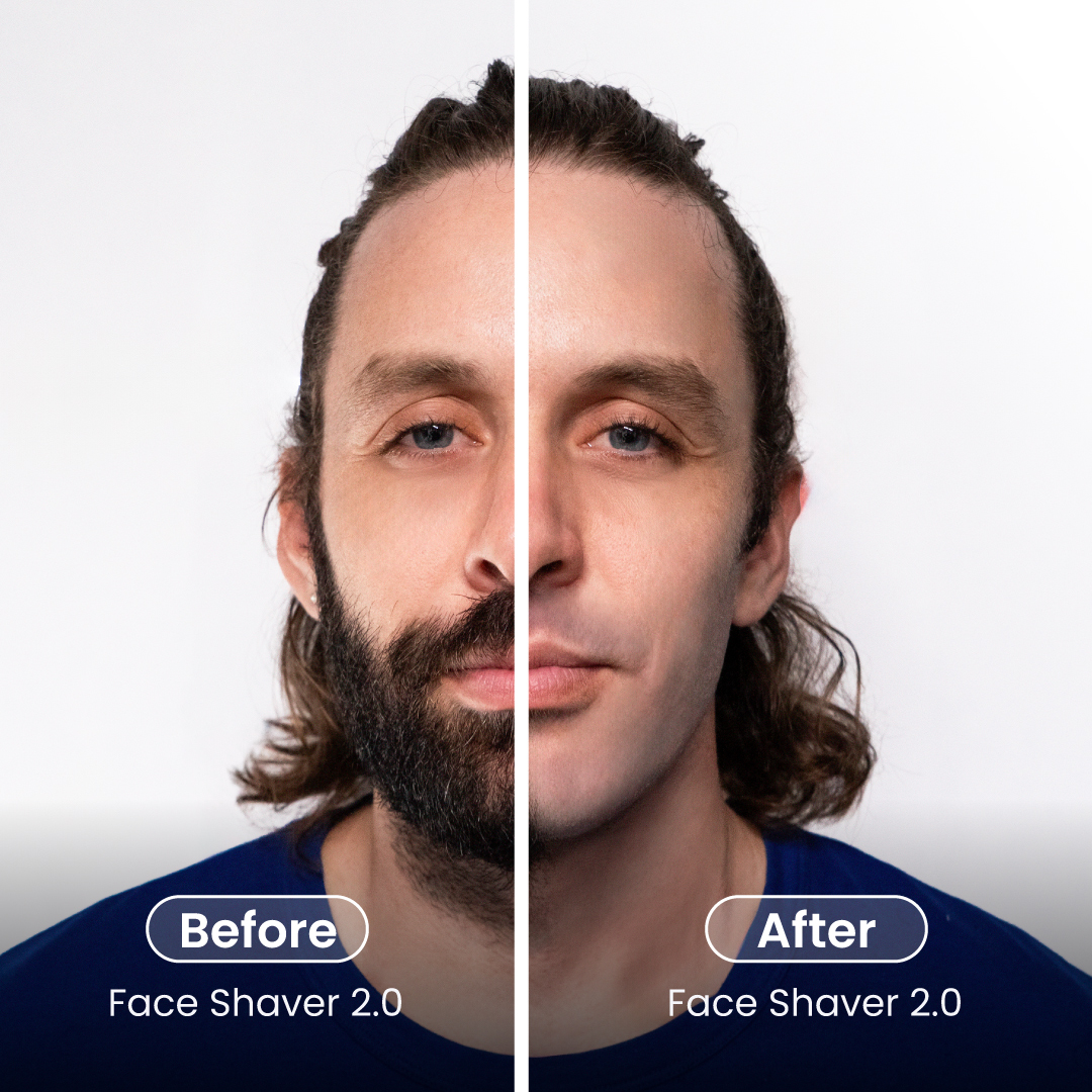 Nateskin Face Shaver 2.0: Electric Facial Hair Shaver No Nicks Wet Dry ...