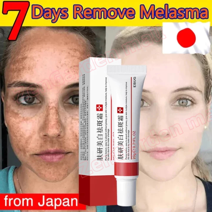 Pigmentation Remove Cream Dark Spot Remover Whitening Freckle Cream ...