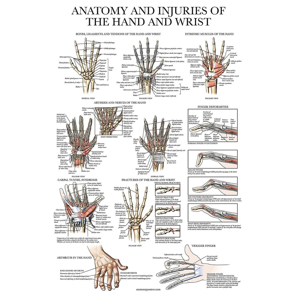 Laminated Anatomy and Injuries of The and Wrist Poster and Wrist Joint ...