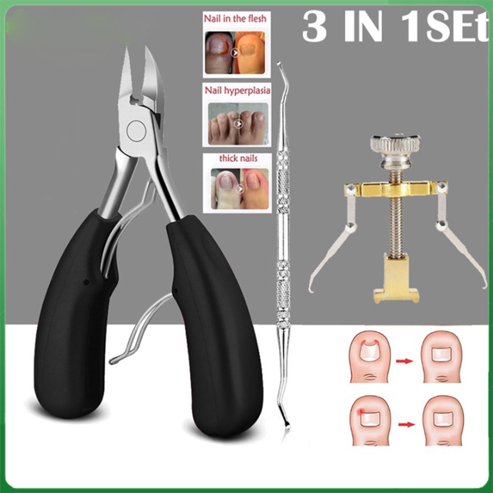 INGROWN TOENAIL Treatment Tool 2/3PC/Set Corrector Clipper Lifter Kit ...