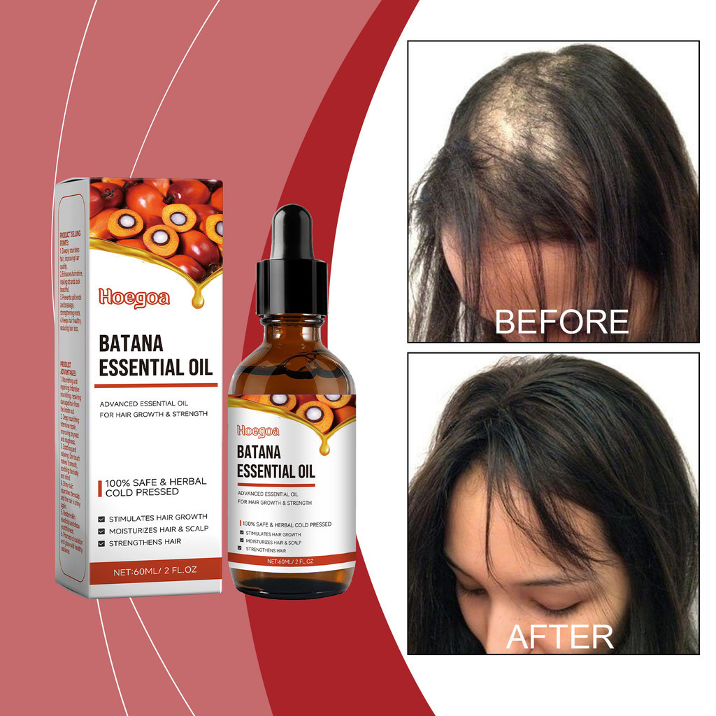 60ml HOEGOA Batana Conditioning Oil Nourish Hair, Soften Strands and ...