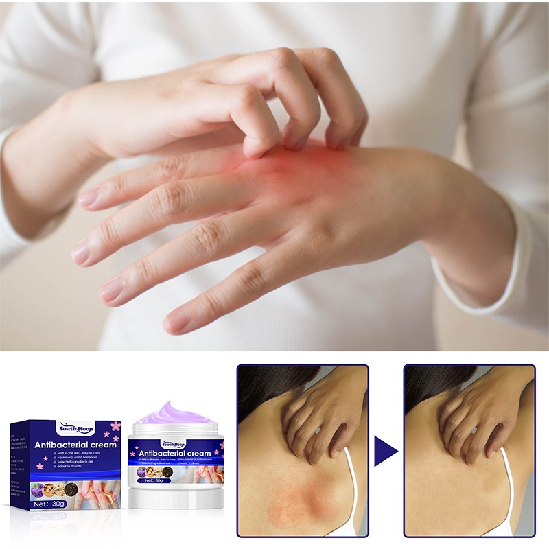 Bioderm Ointment Atopoderma Cream 30g - Treats Itching, Eczema and Skin ...