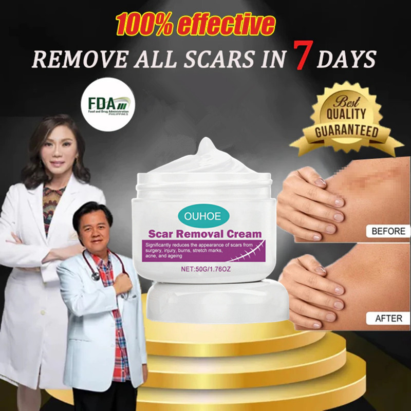 Scar Remover Cream Old Scar Remover Cream For Legs Peklat Remover ...
