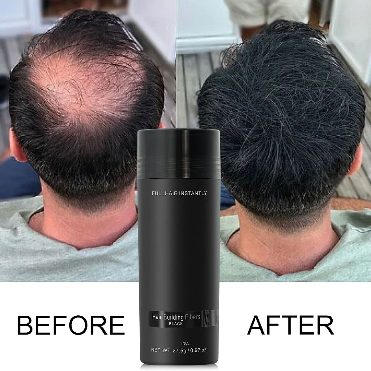 Keratin Hair Building Fiber Set For Sparse Bald Spots Loss Regrowth ...