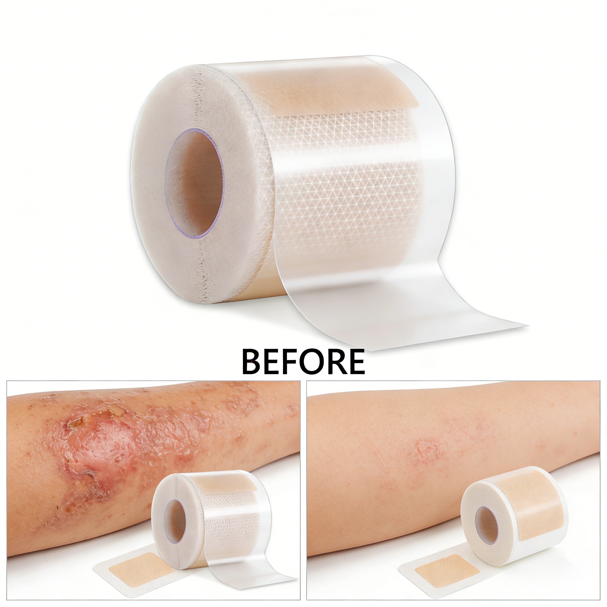 Long-Lasting Scar Patch - Invisible Self-Adhesive Silicone Gel Sheet ...