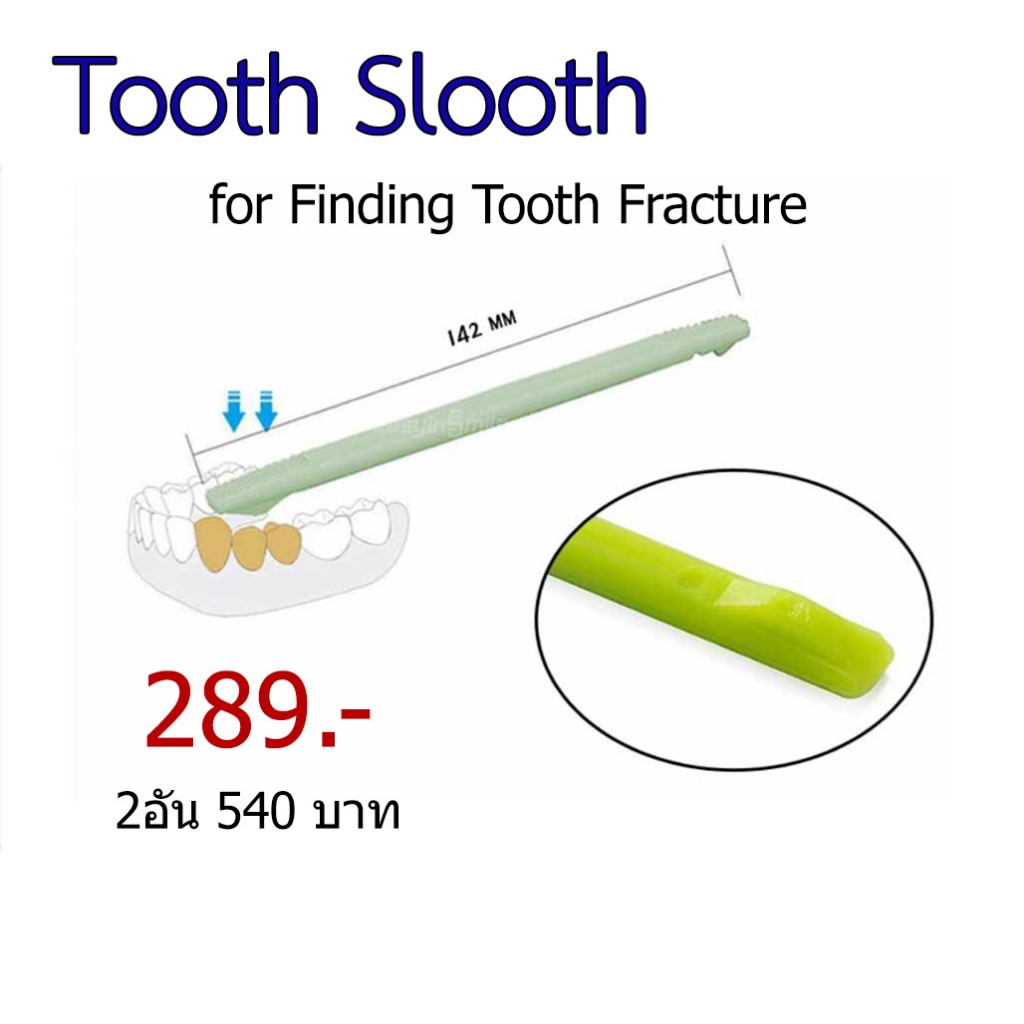 tooth Slooth/Fracfinder That Bites For Cracked Teeth crack | Shopee ...