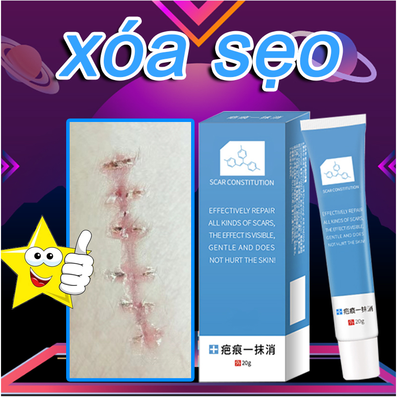 [GENUINE] Scar fading cream to fade dark spots, keloid scars, concave ...