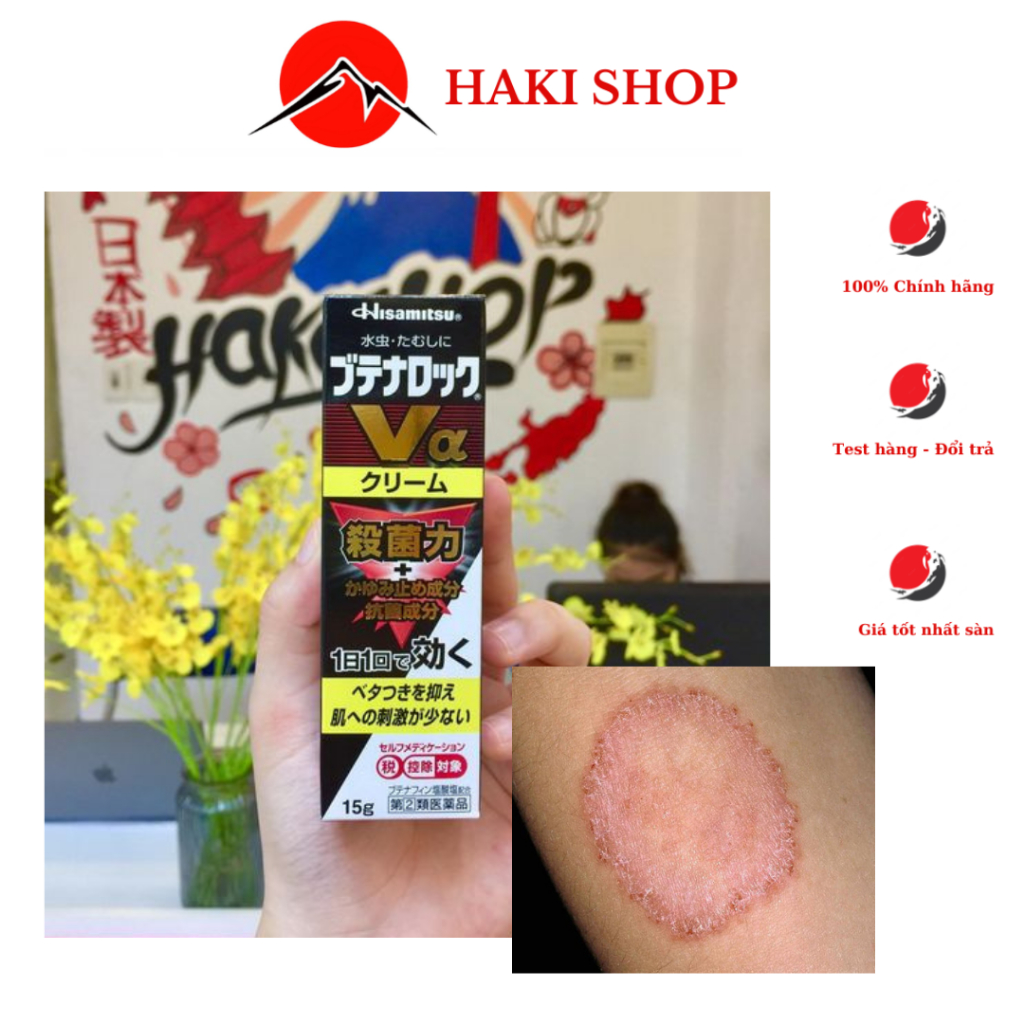 Hisamitsu No. 1 cream to reduce itchy fungus and ringworm in Japan ...