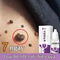 Mole removal recovery solution 10Ml, Moles/Black moles/Fly moles/Milia ...